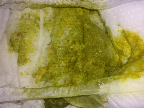 大人肠炎大便图片肠癌早期拉屎照片5 伤感说说吧